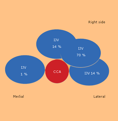 Anatomical Variation